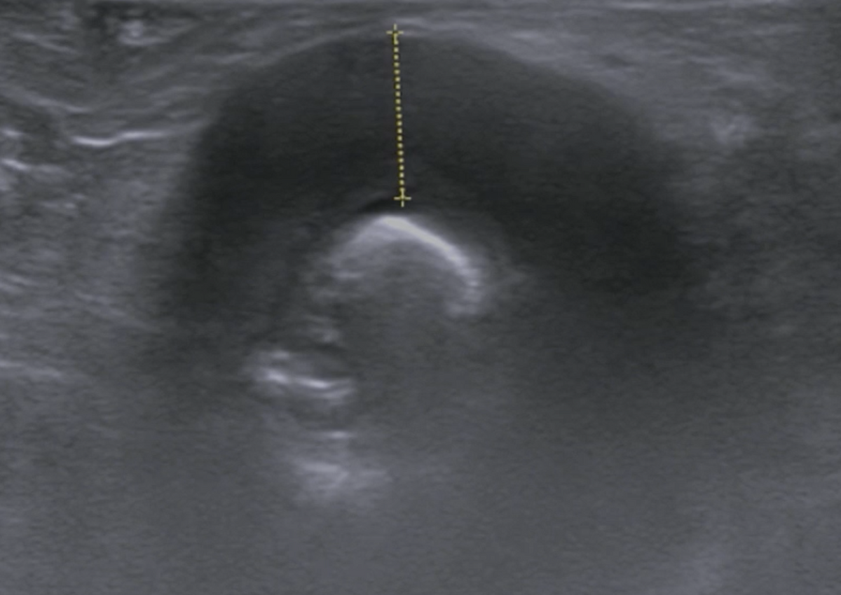 Blood and Guts - Assessment of the Patient with GI Bleeding – Vet Show ...